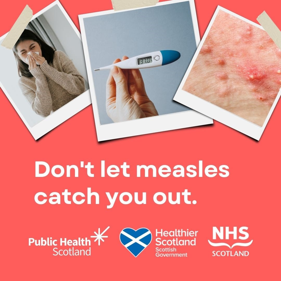 NHS highlights importance of measles vaccination to safeguard public ...